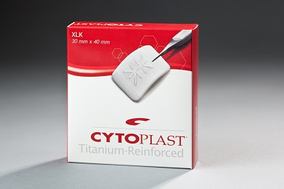 Cytoplast® Ti-150 Titanium PTFE Membranes – OsseoDent™